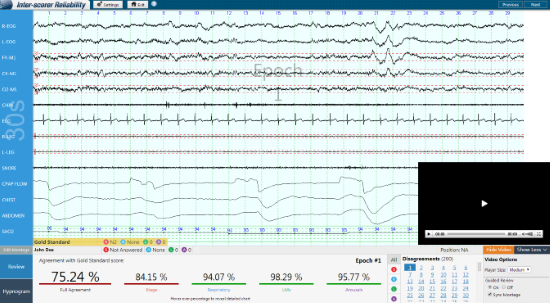 AASM Inter-scorer Reliability Help