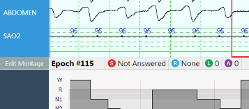 AASM Inter-scorer Reliability Help