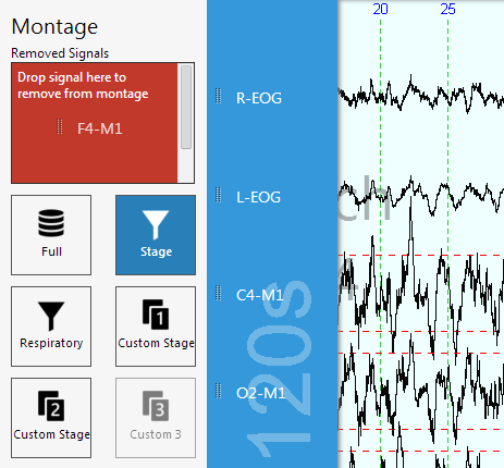 AASM Inter-scorer Reliability Help